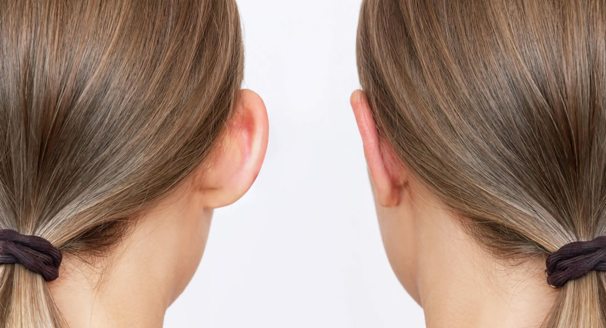 Cosmetic Ear Laser Surgery - Laser Otoplasty - Dr Ciric